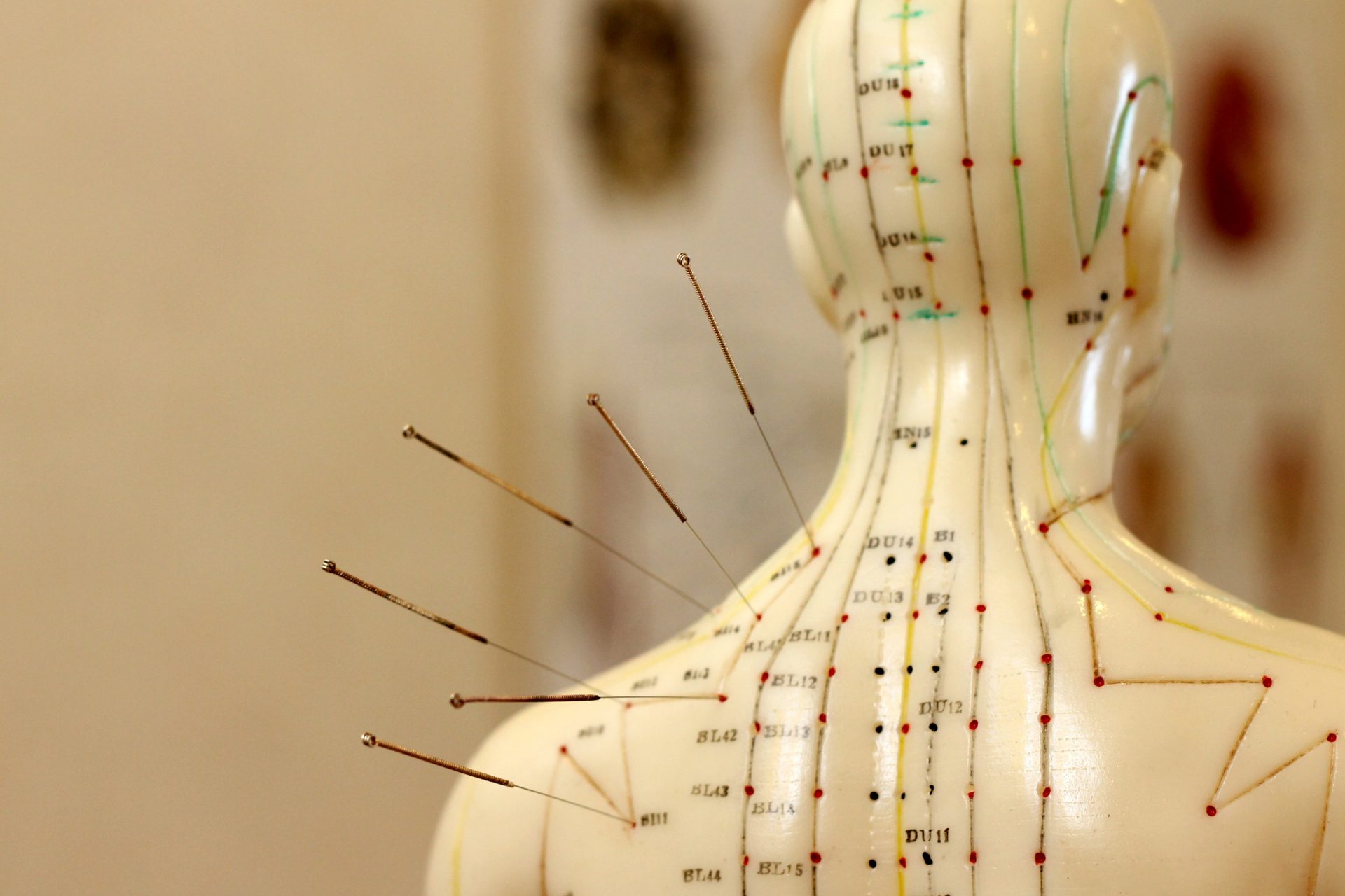 klinikakupunktur.com – klinik akupunktur ternama dan terpercaya di ...